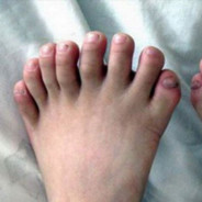 Steam Community :: Toes®™